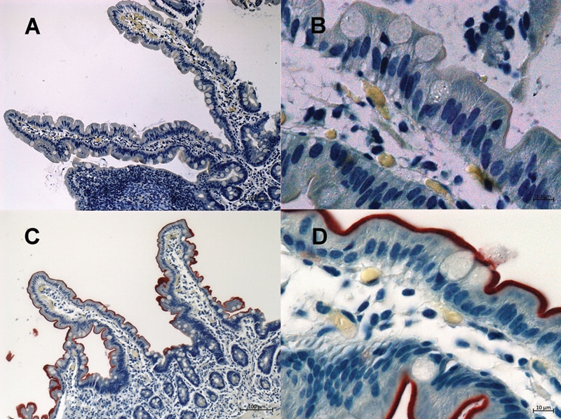 PCH2cure Work Package: Gastrointestinal Symptoms in PCH2A - PCH2cure